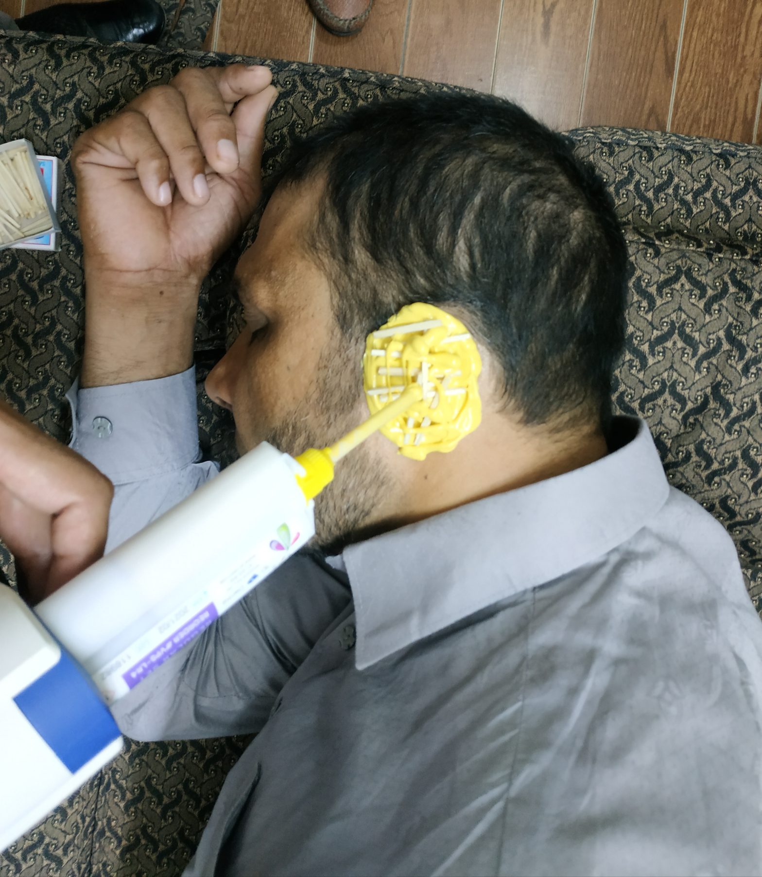 Anaplastology and silicone prosthesis service's in Pakistan | Chughtai ...